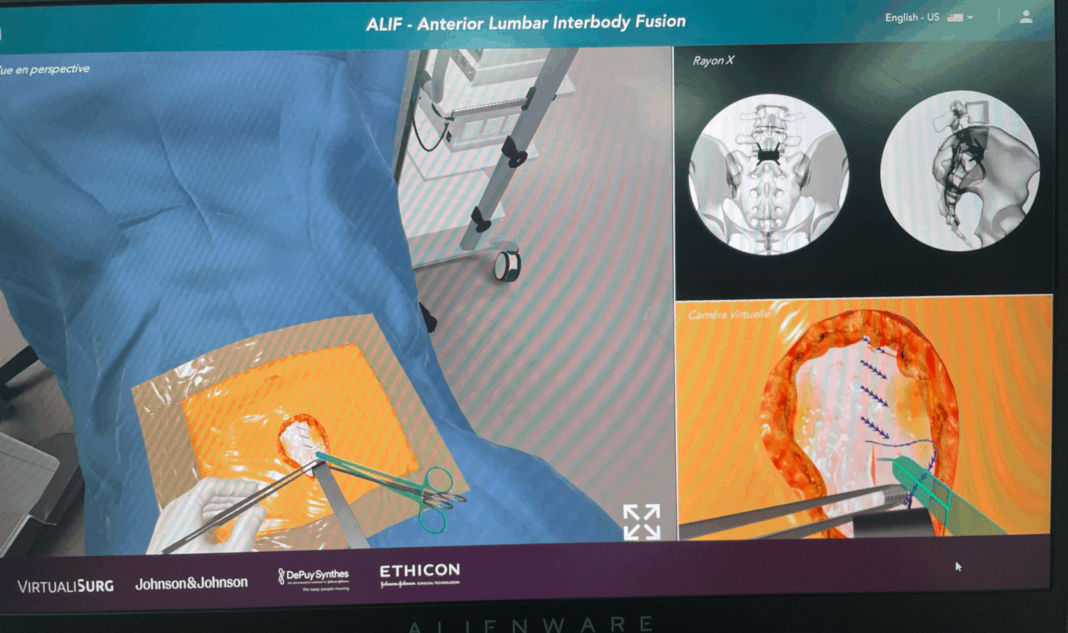 XR in the OR: XR ALIF training simulation in the real operating room ...